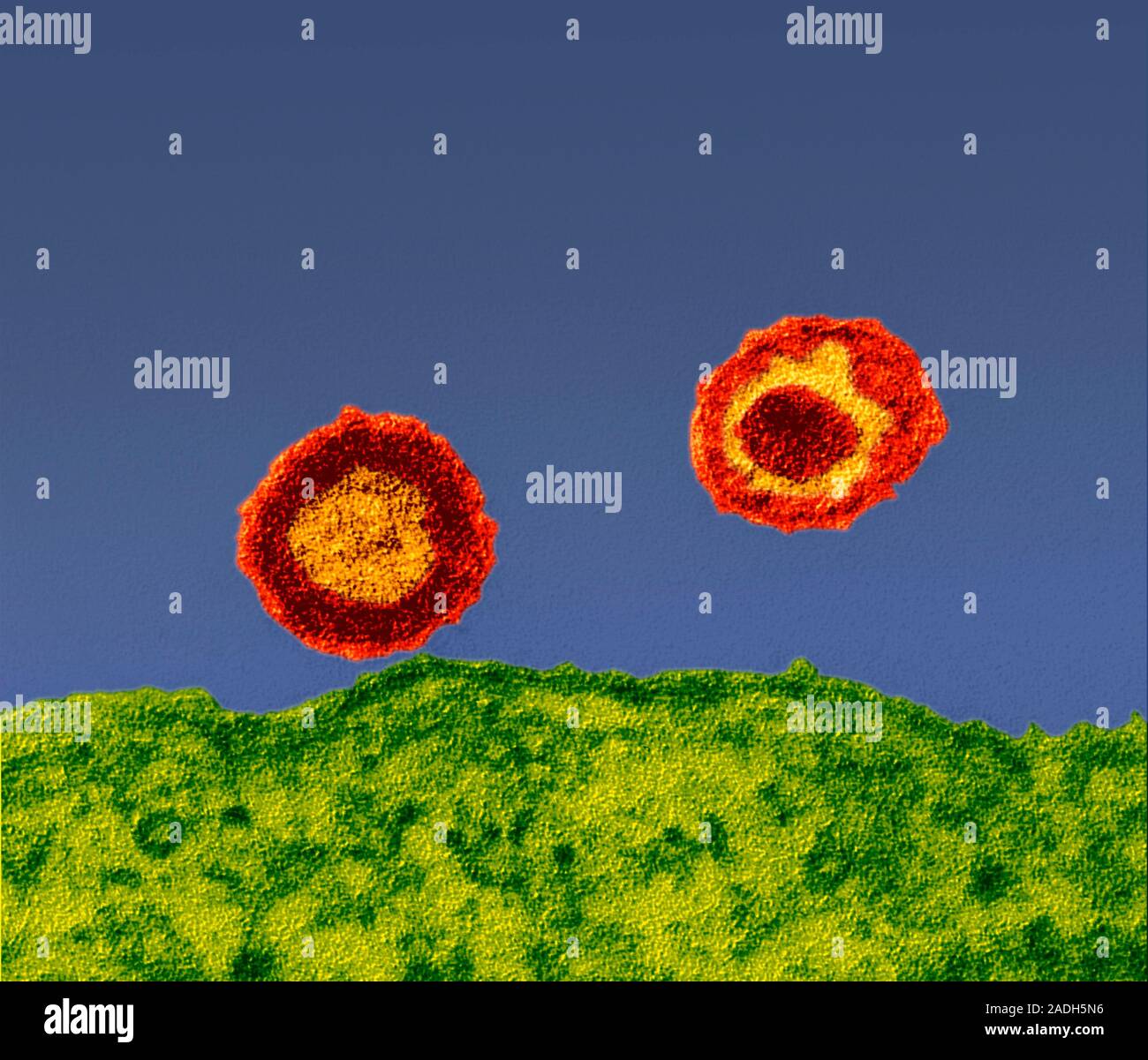 HIV particles. Coloured transmission electron micrograph (TEM) of human ...