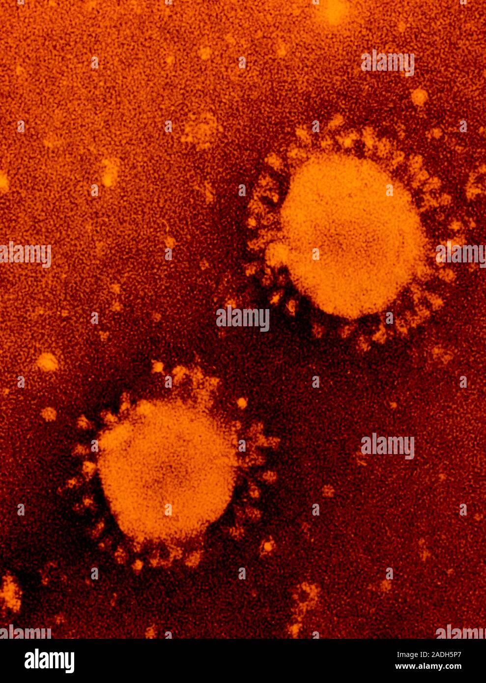 False-colour transmission electron micrograph (TEM) of a pair of corona ...