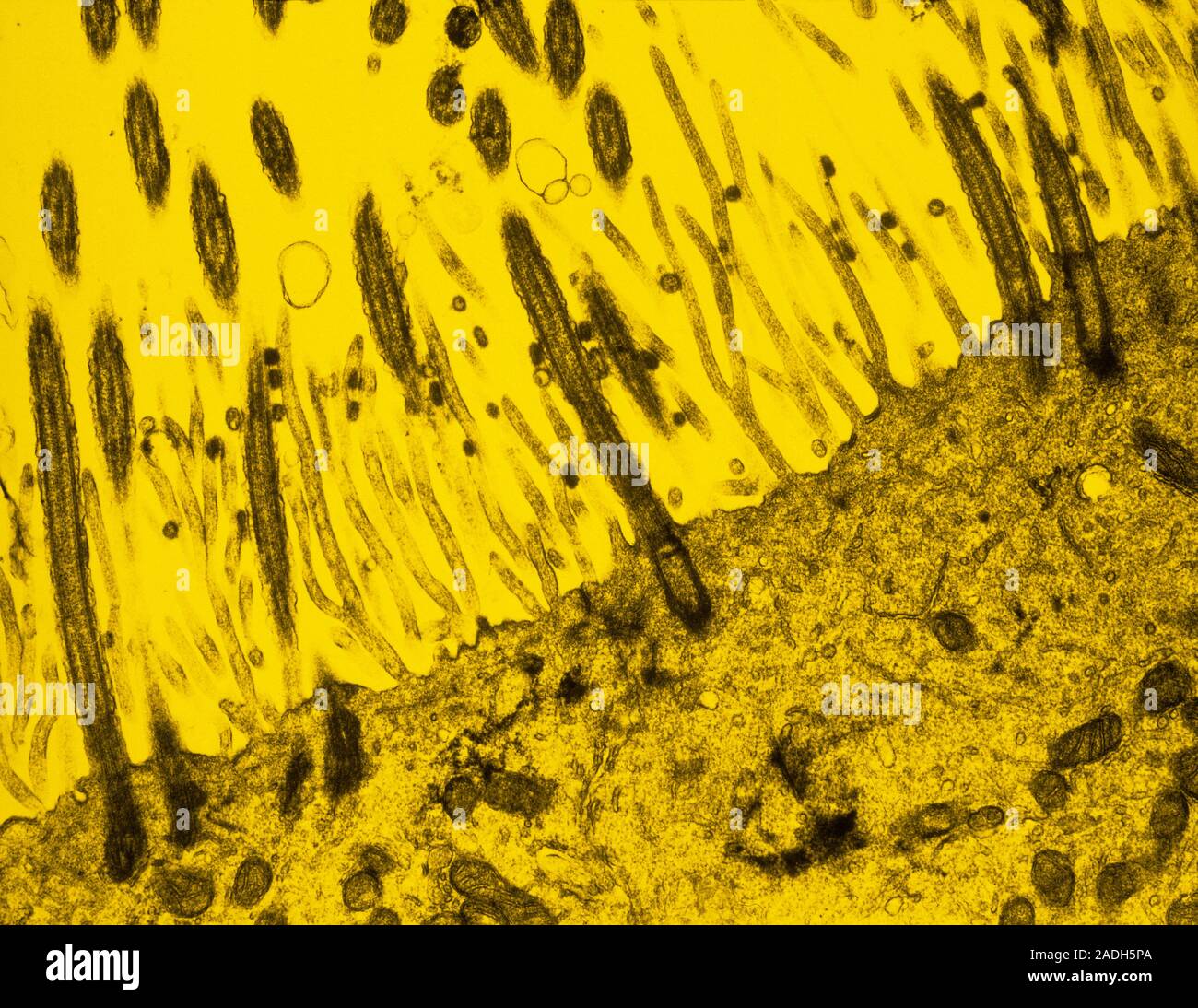 Transmission electron micrograph (TEM), tinted yellow, of a section ...