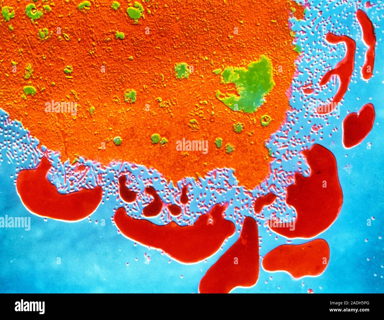 False-colour transmission electron micrograph (TEM) of red blood cells ...