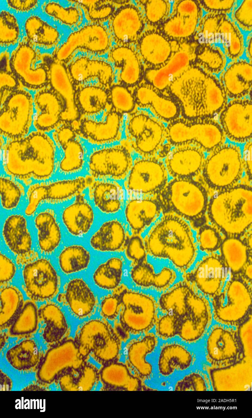 False-colour transmission electron micrograph of an influenza or flu ...