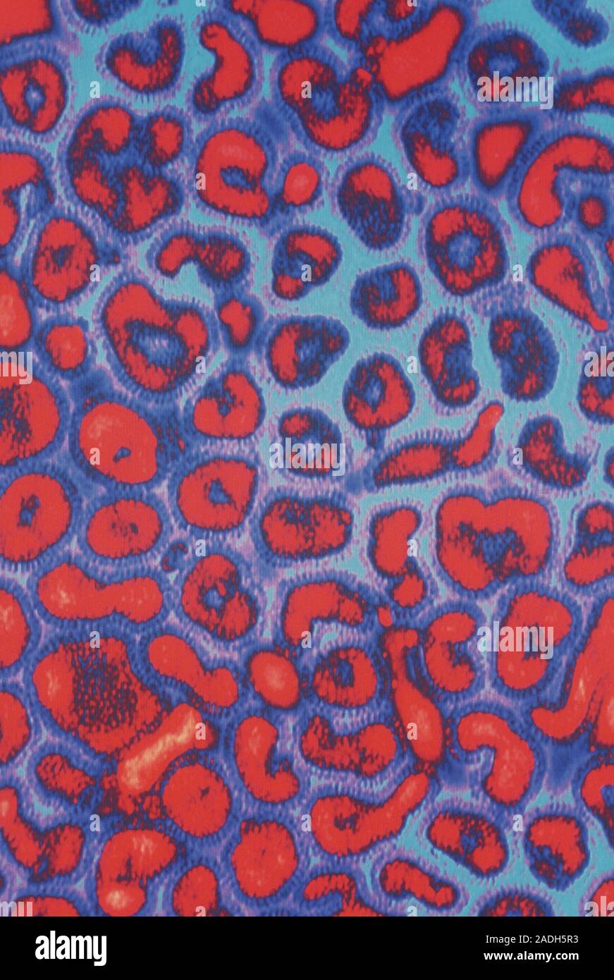 False-colour transmission electron micrograph of an influenza or flu ...