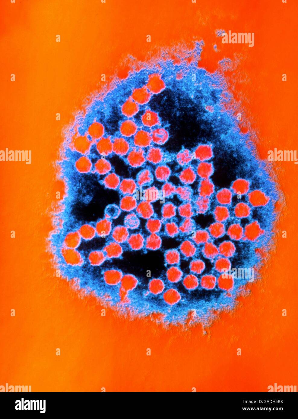 False-colour transmission electron micrograph of a group of rhinoviruses. The rhinovirus is one ...