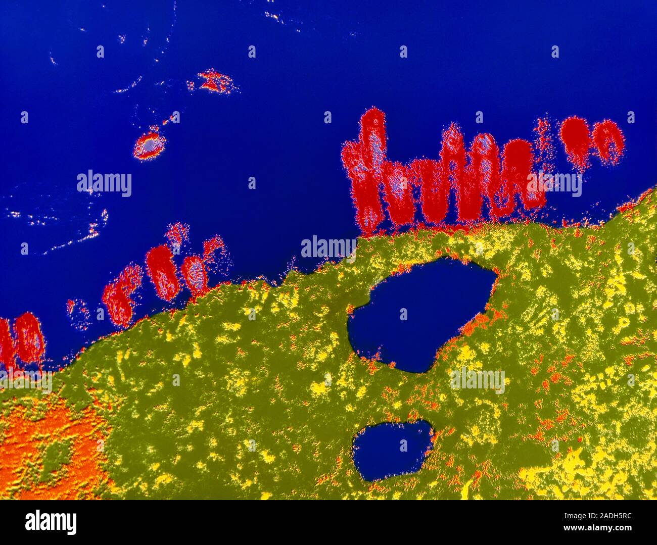 False-colour transmission electron micrograph of a cell infected by ...