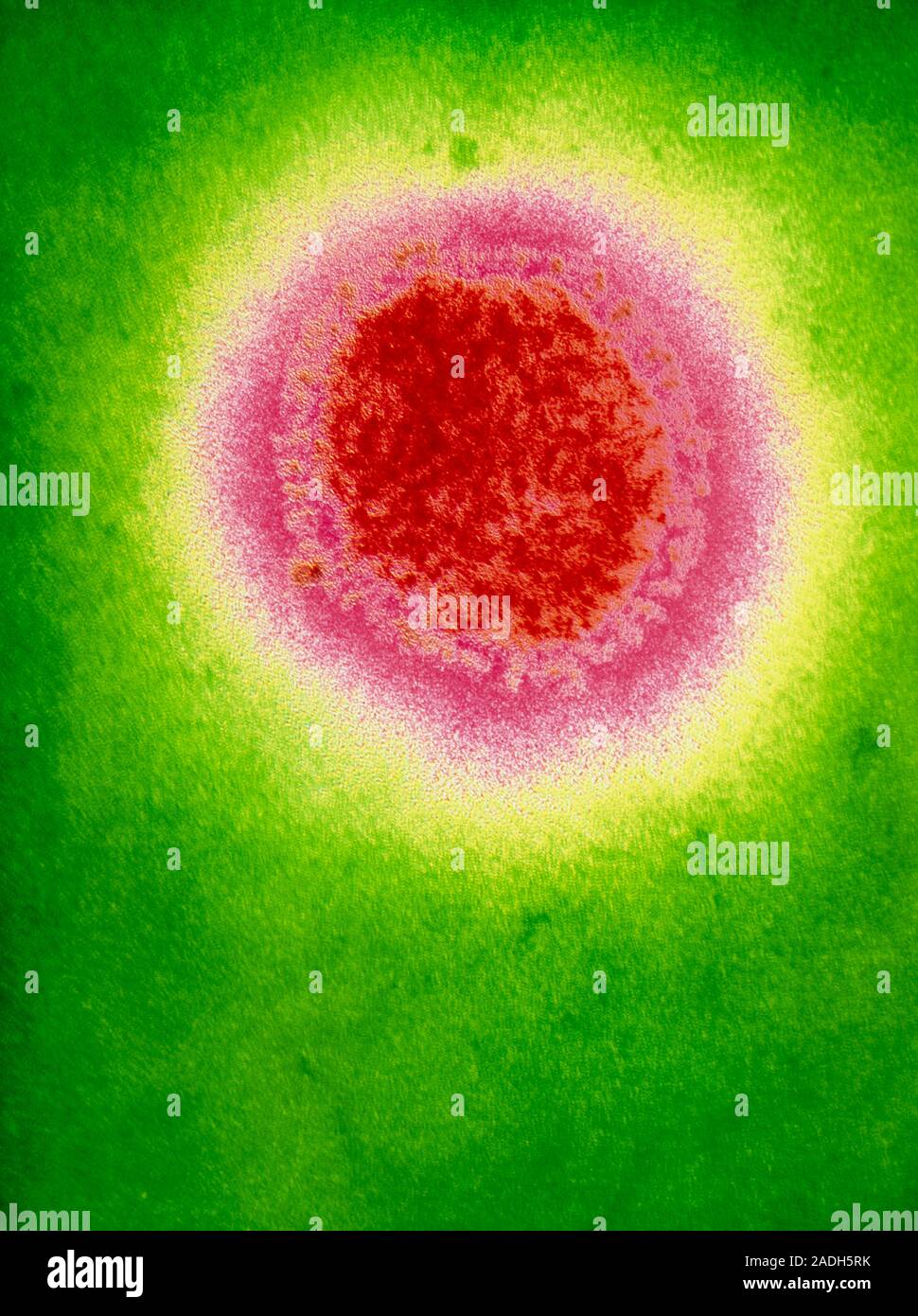 Influenza virus. Coloured transmission electron micrograph (TEM) of a ...
