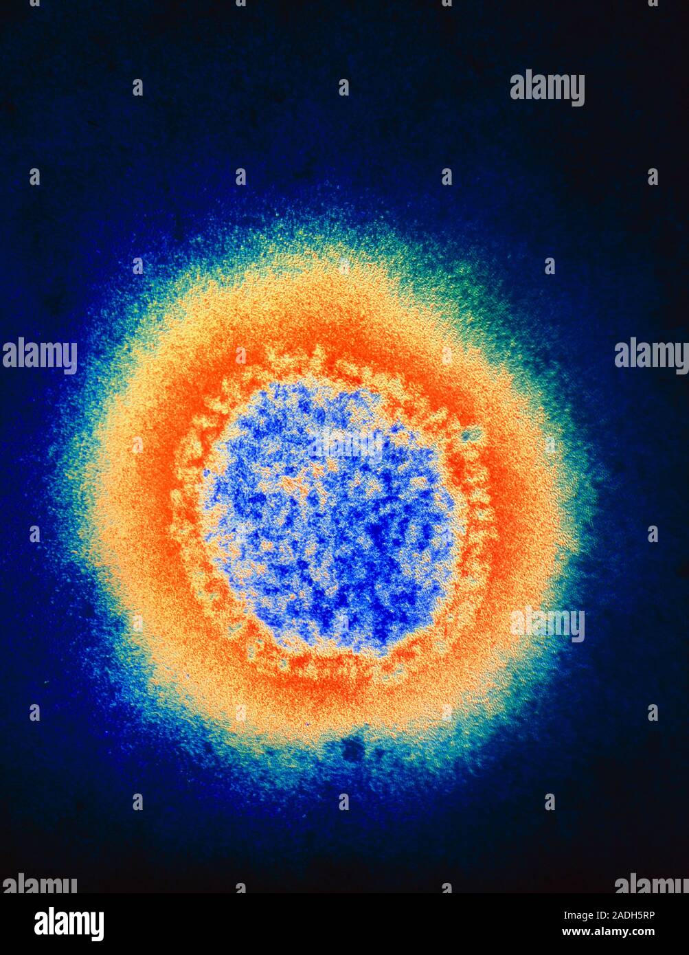 Influenza virus. Coloured transmission electron micrograph (TEM) of a ...