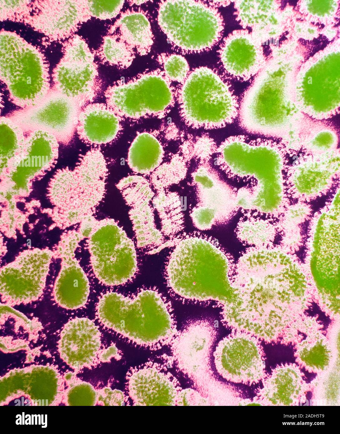 Asian flu virus. Coloured transmission electron micrograph of Asian ...