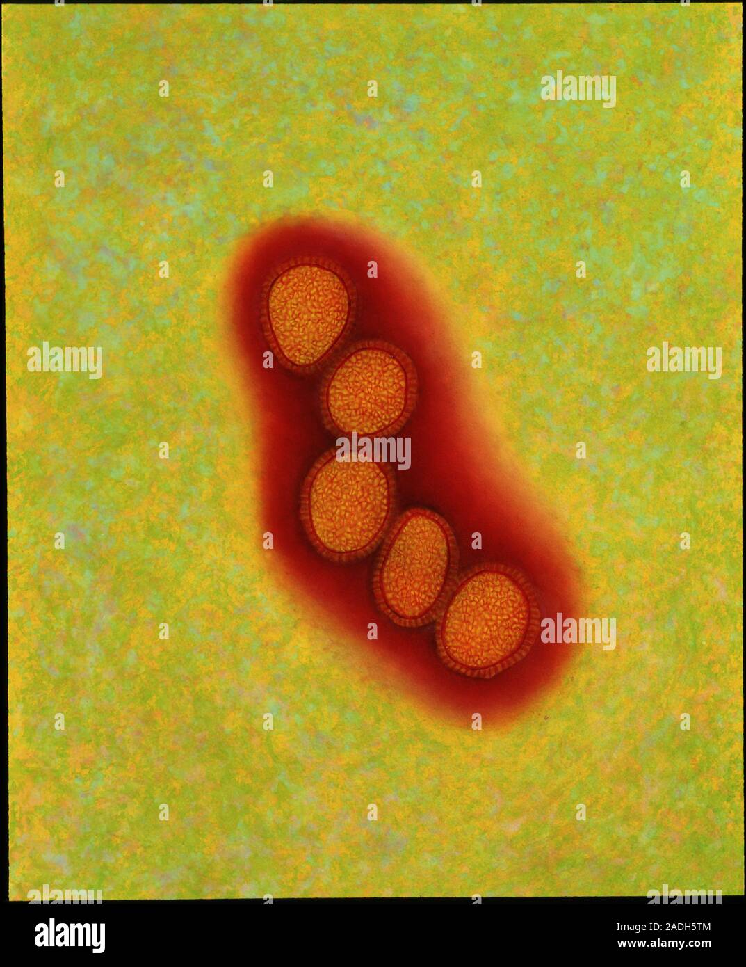 Influenza virus. Coloured transmission electron micrograph of a cluster ...