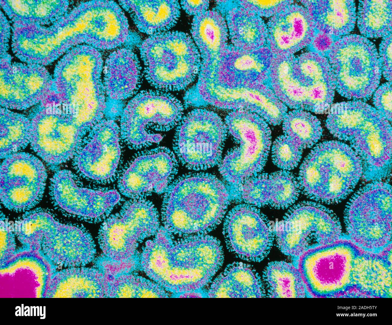 Influenza viruses. Coloured transmission electron micrograph (TEM) of a ...