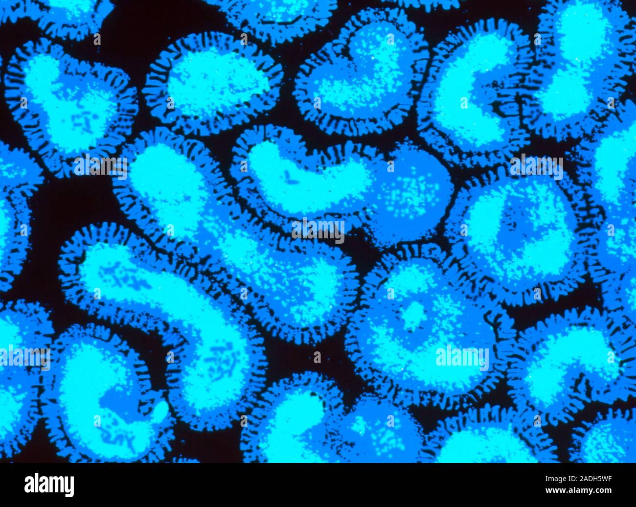 Influenza viruses. Coloured transmission electron micrograph (TEM) of a ...