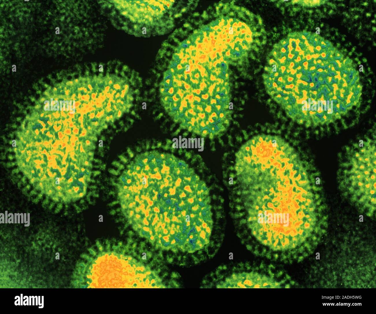 Influenza viruses. Coloured transmission electron micrograph (TEM) of a ...