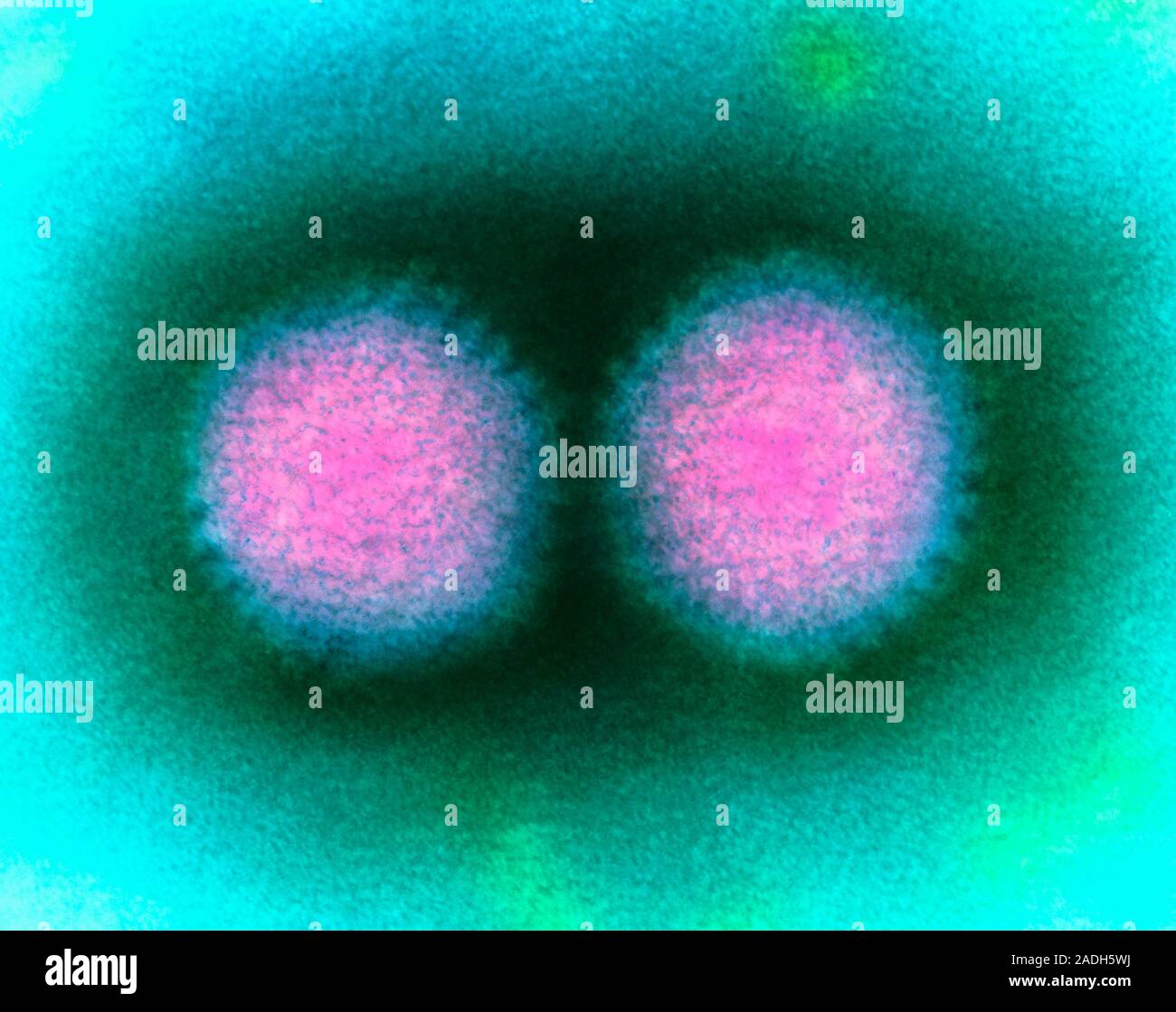 Adenoviruses. Coloured transmission electron micrograph (TEM) of two ...