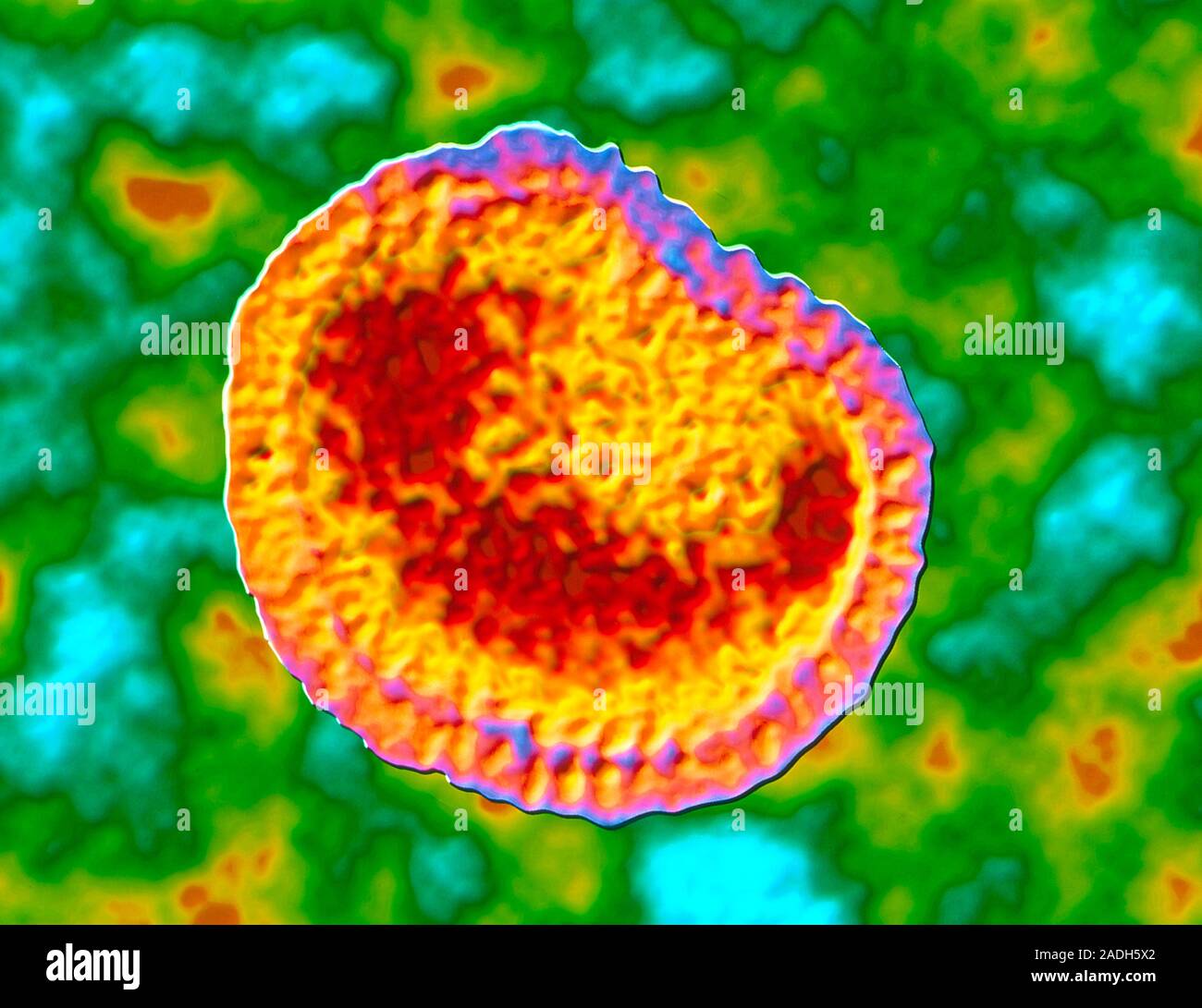 Influenza virus. Coloured transmission electron micrograph (TEM) of an ...