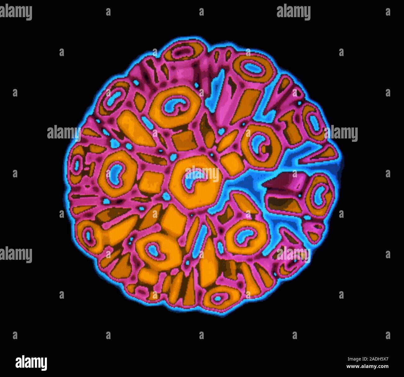 Common cold virus. Computer artwork of a rhinovirus particle, the most ...