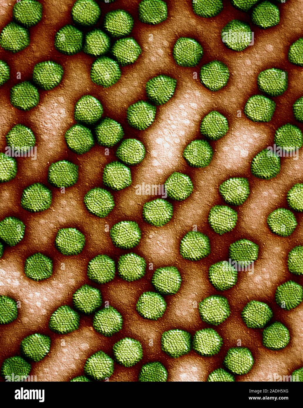 Adenoviruses. Coloured transmission electron micrograph (TEM) of a ...