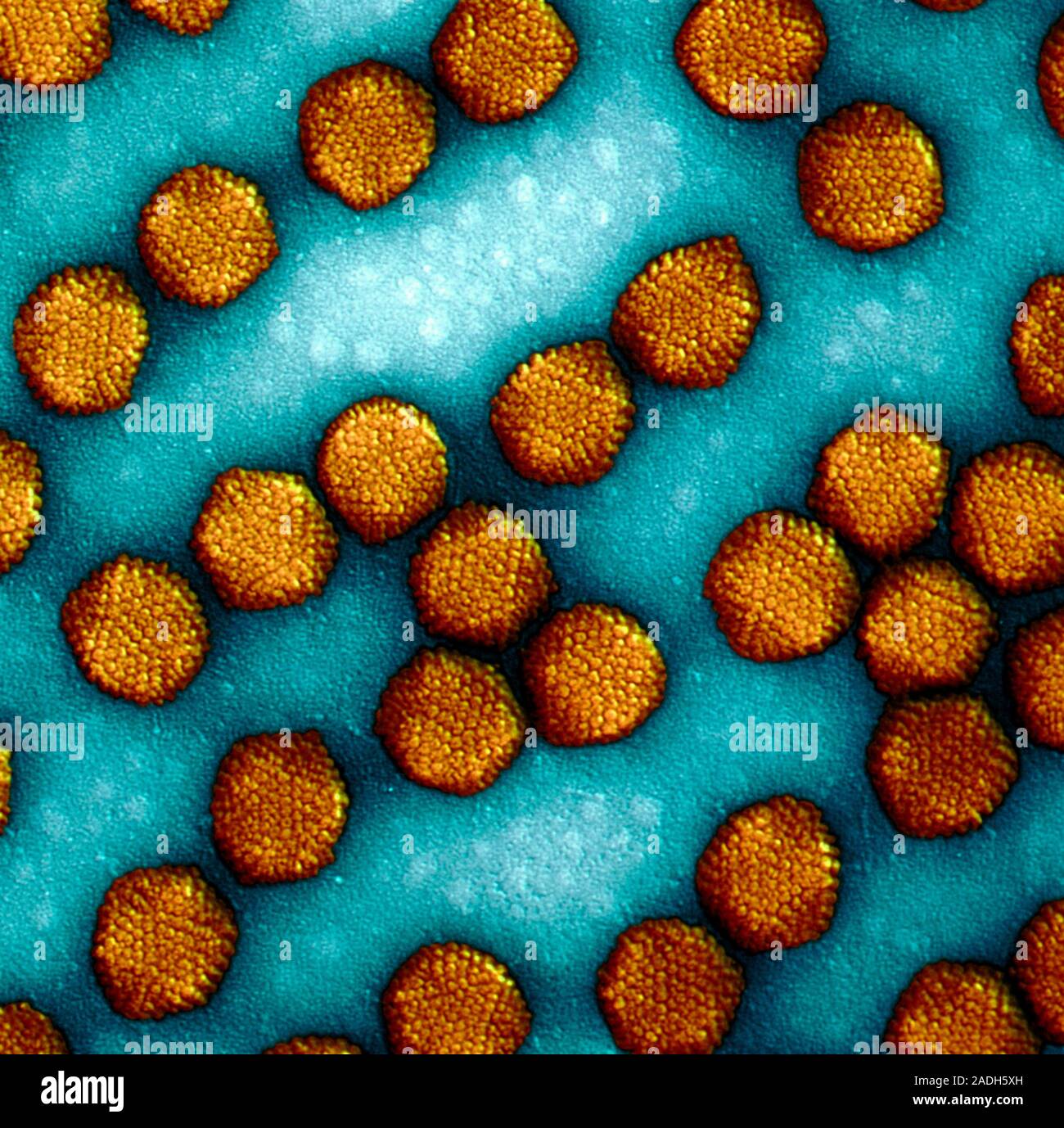 Adenoviruses. Coloured transmission electron micrograph (TEM) of a ...