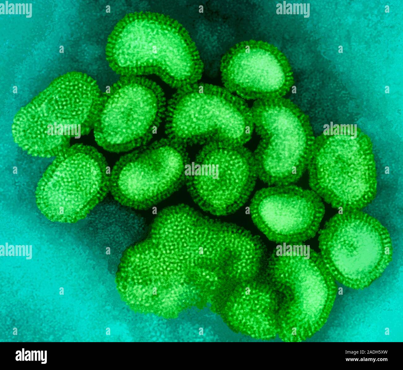 Influenza viruses. Coloured transmission electron micrograph (TEM) of ...