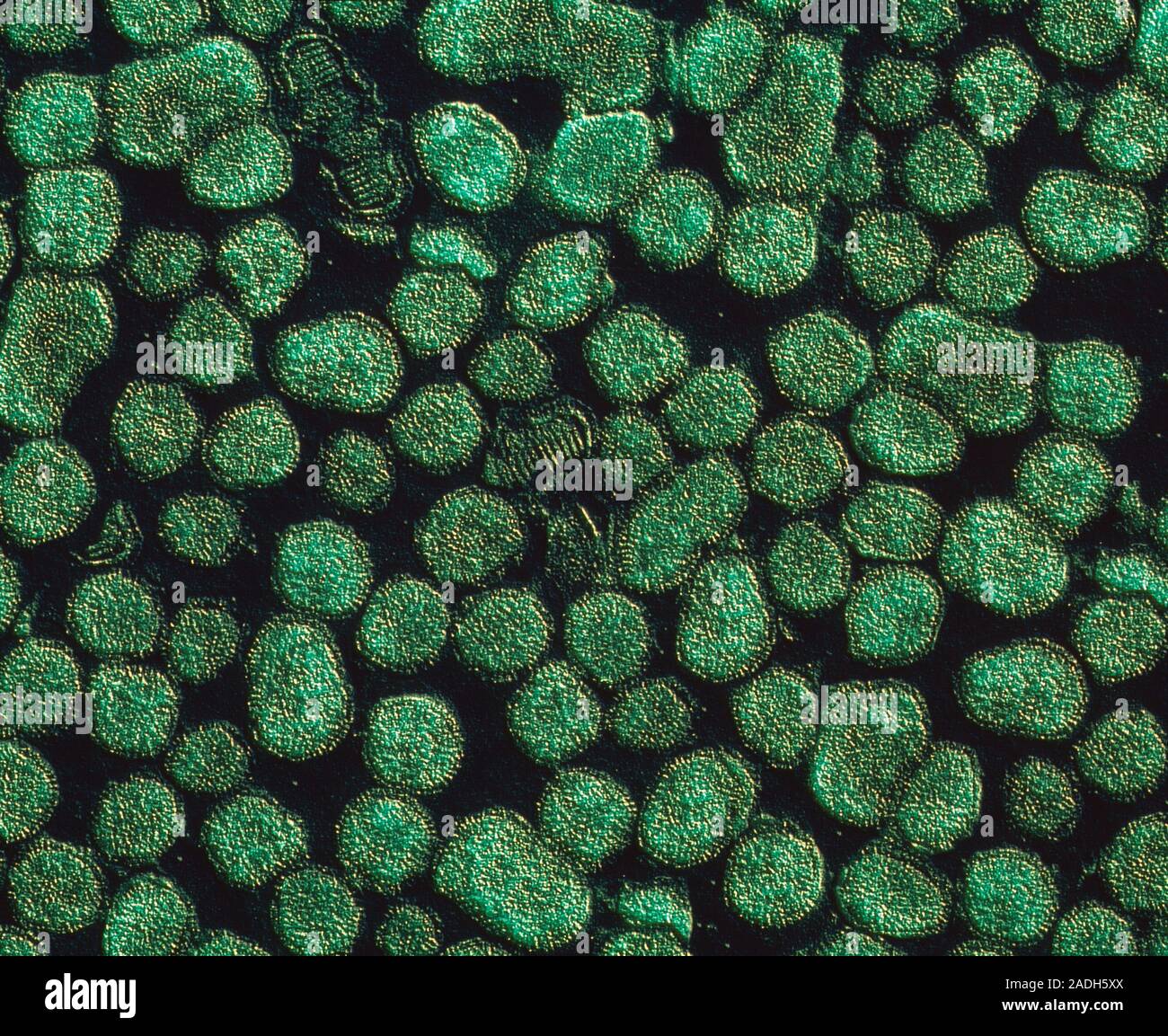 Influenza virus particles. Coloured transmission electron micrograph ... Influenza virus particles. Coloured transmission electron micrograph ...
