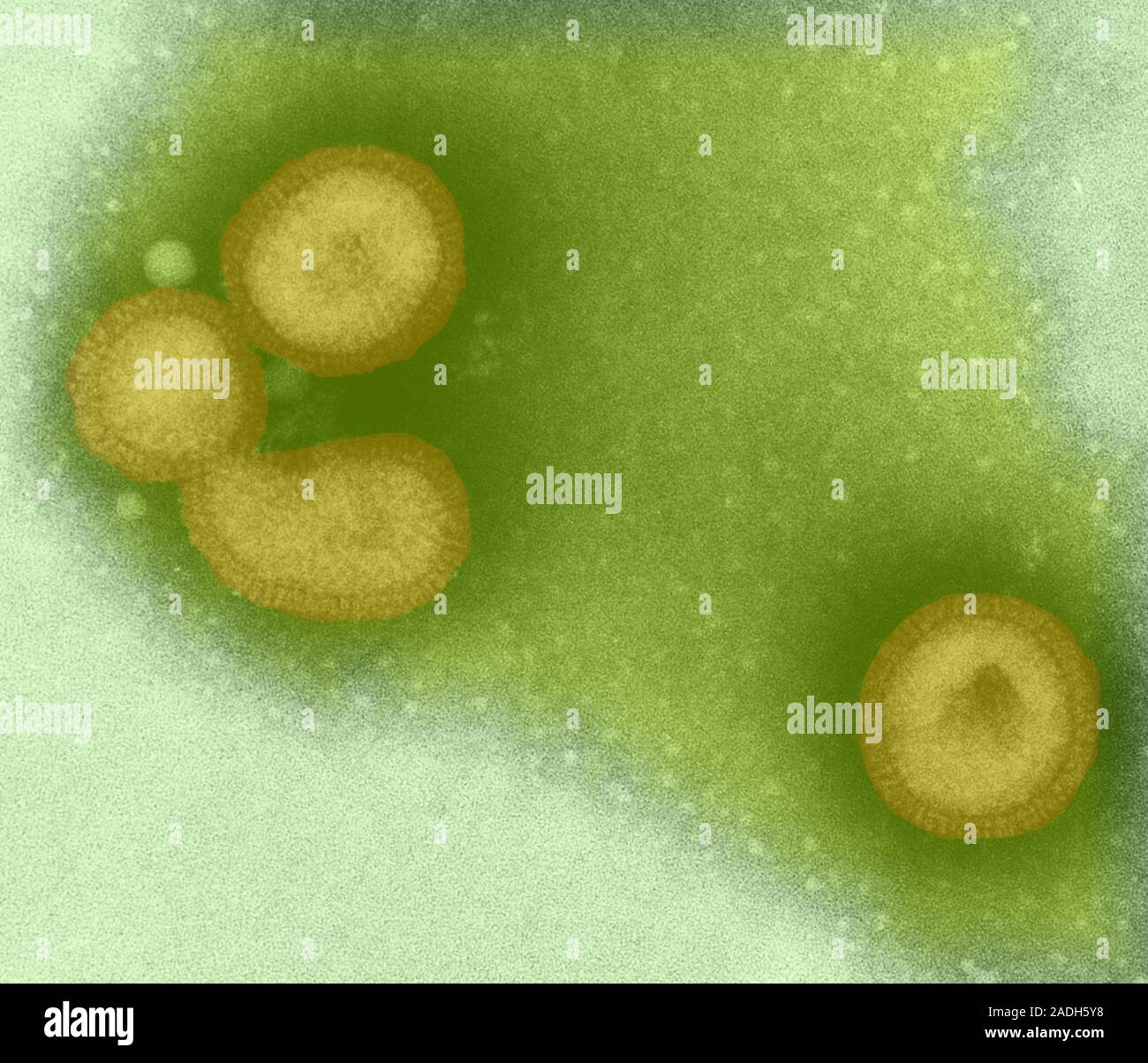 Influenza viruses. Coloured transmission electron micrograph (TEM) of influenza B virus ...