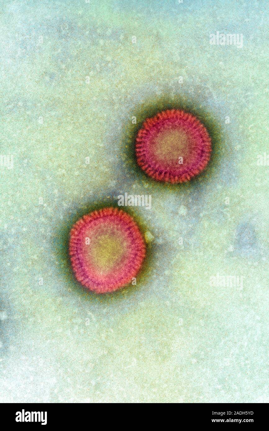Influenza viruses. Coloured transmission electron micrograph (TEM) of a ...