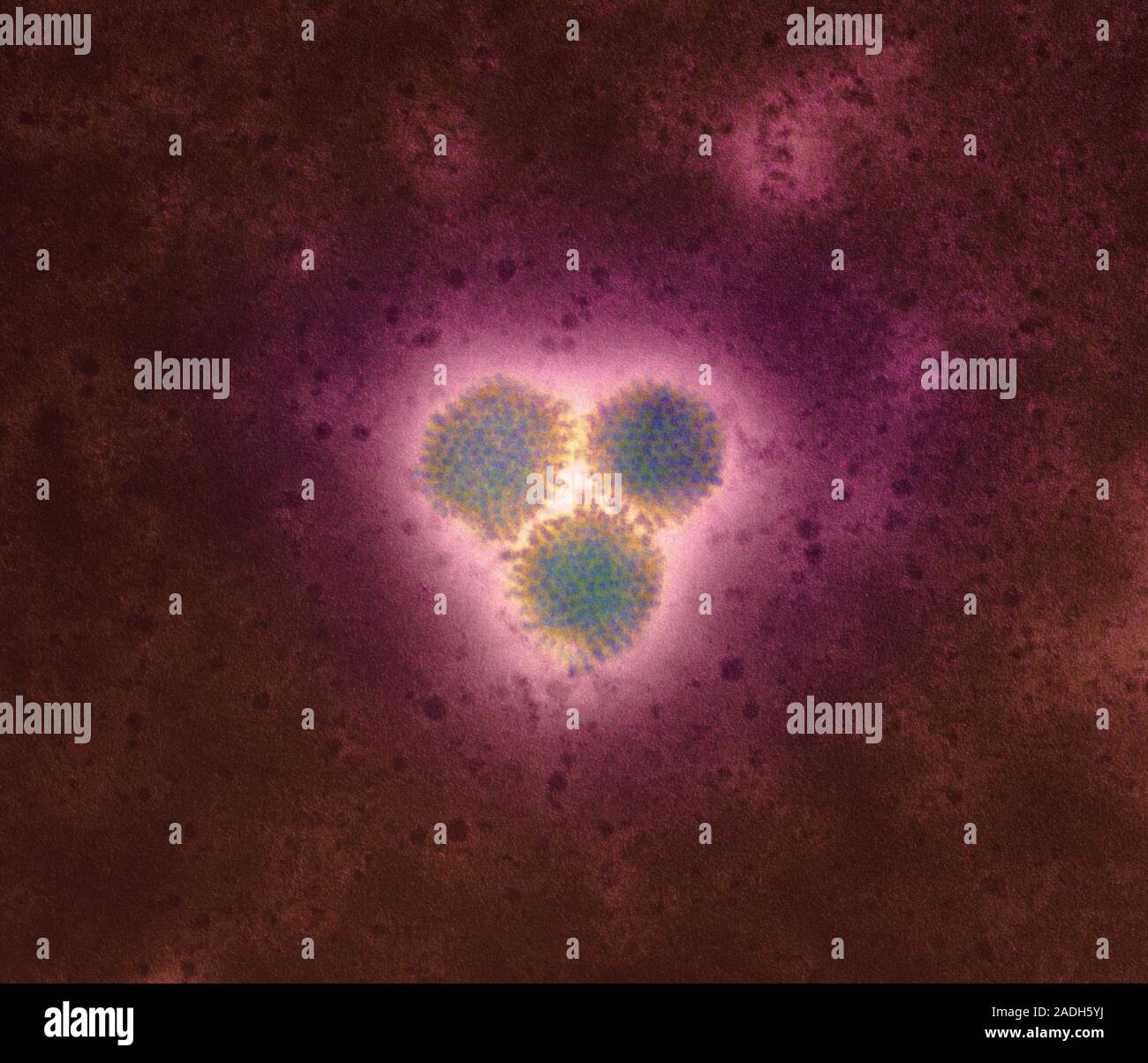 Adenoviruses. Coloured transmission electron micrograph (TEM) of three ...