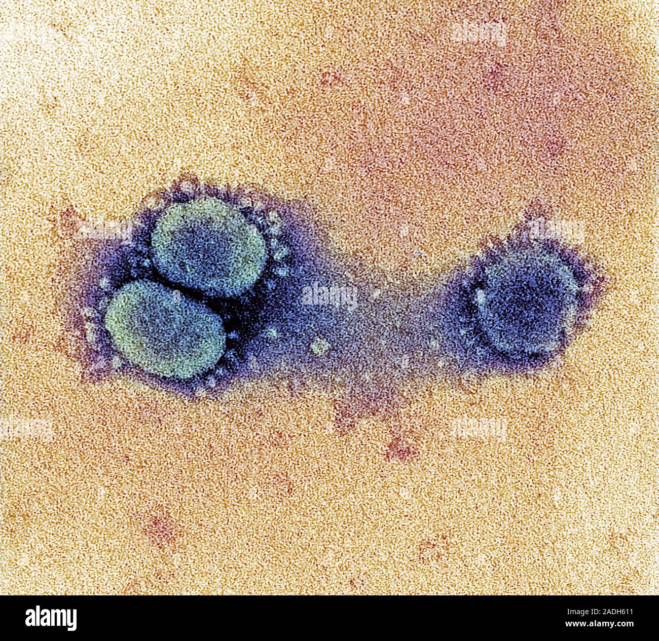 Coronavirus particles, coloured transmission electron micrograph (TEM ...