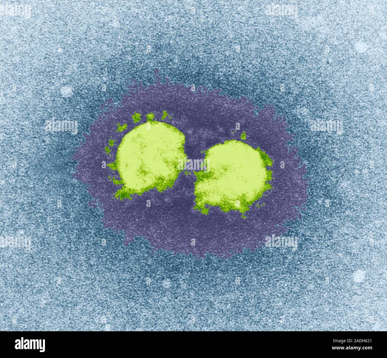 SARS virus particles. Coloured transmission electron micrograph (TEM ...