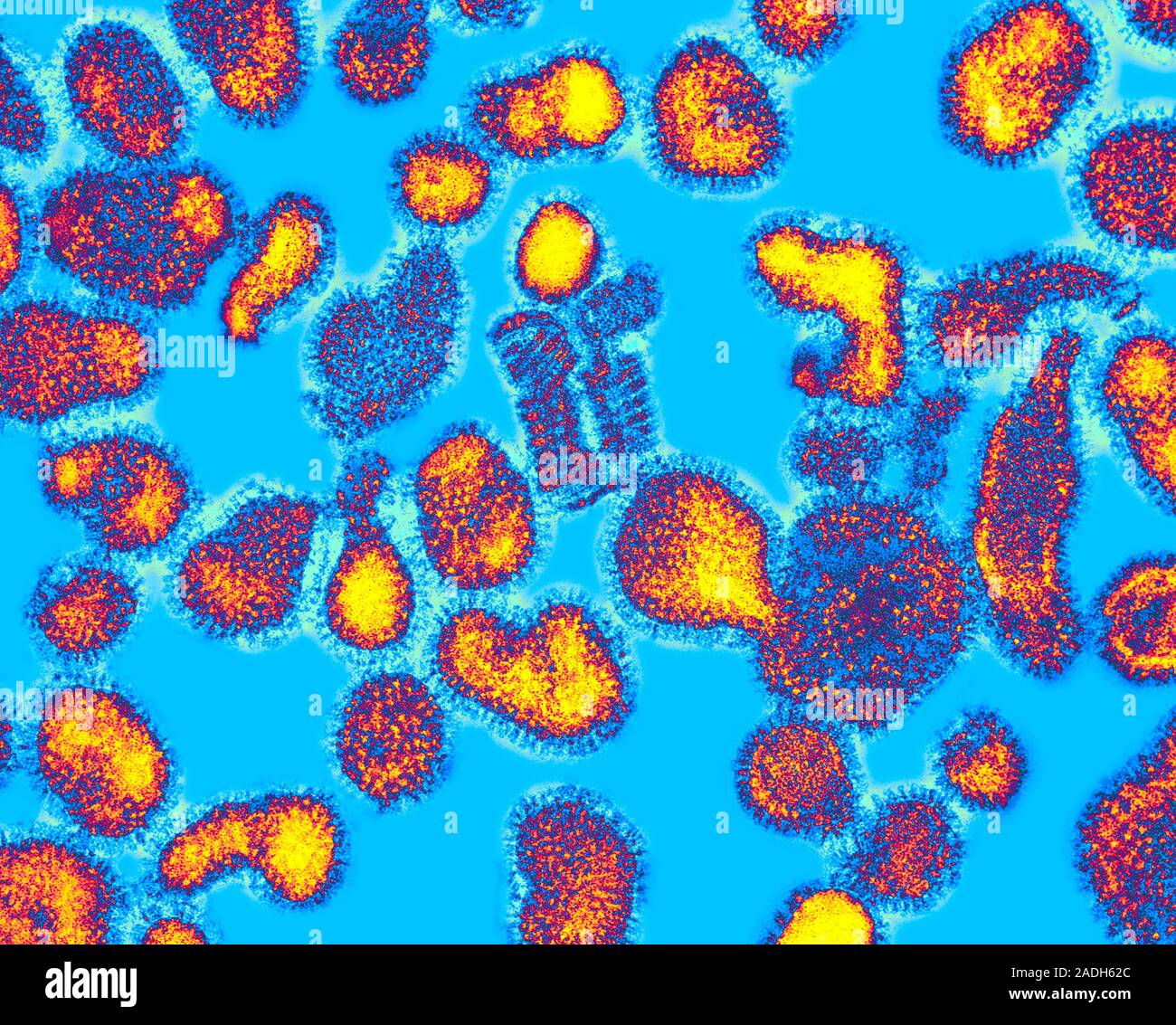 Asian flu viruses. Coloured transmission electron micrograph (TEM) of virions (virus particles ...