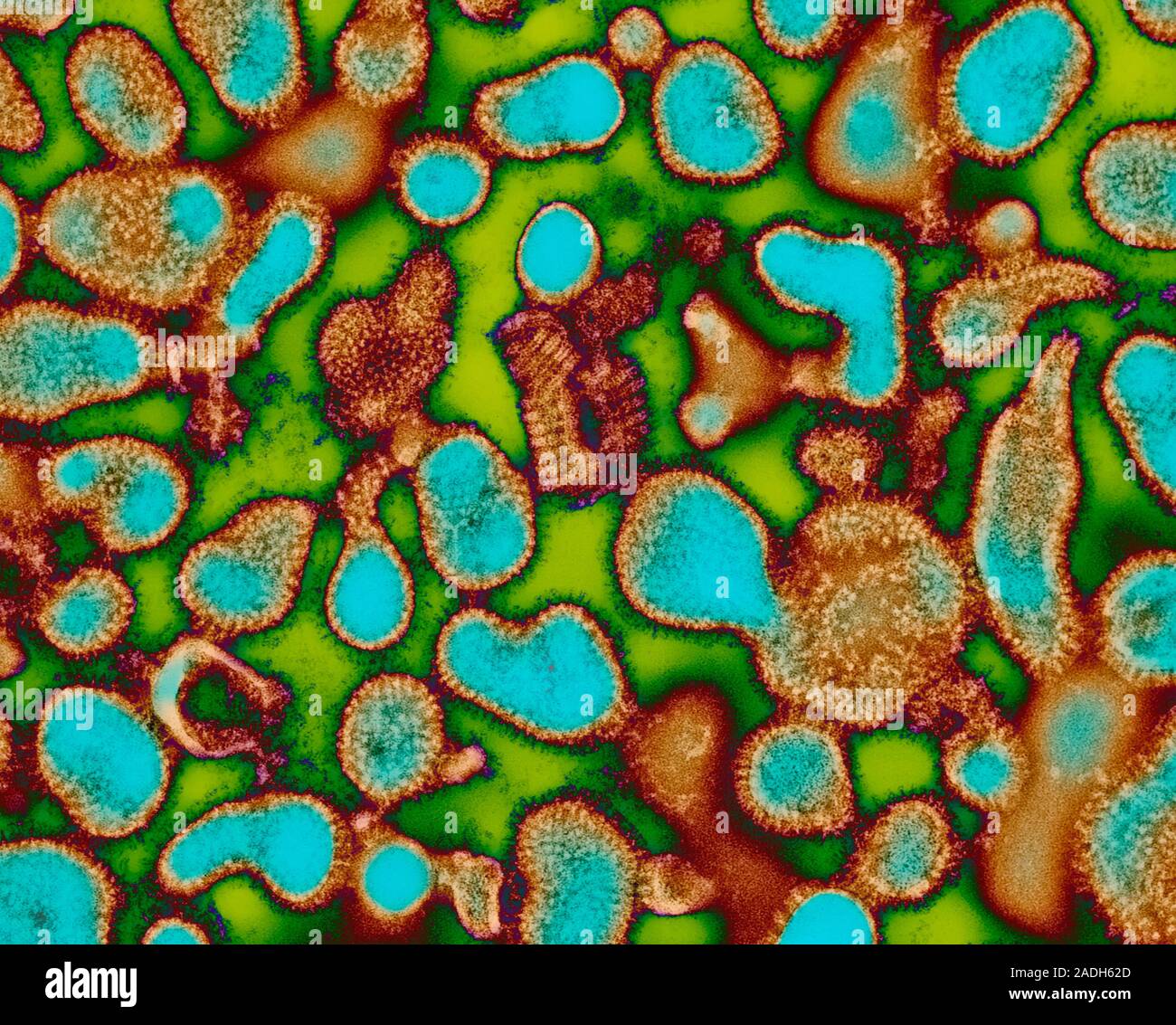 Asian flu viruses. Coloured transmission electron micrograph (TEM) of virions (virus particles ...