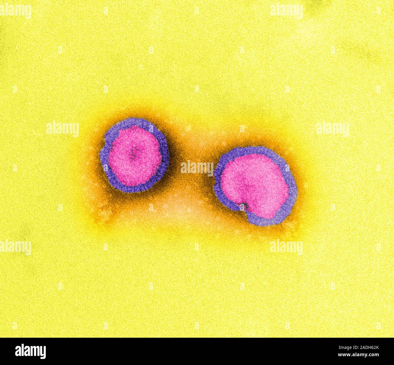 Influenza virus, coloured transmission electron micrograph (TEM). This ...