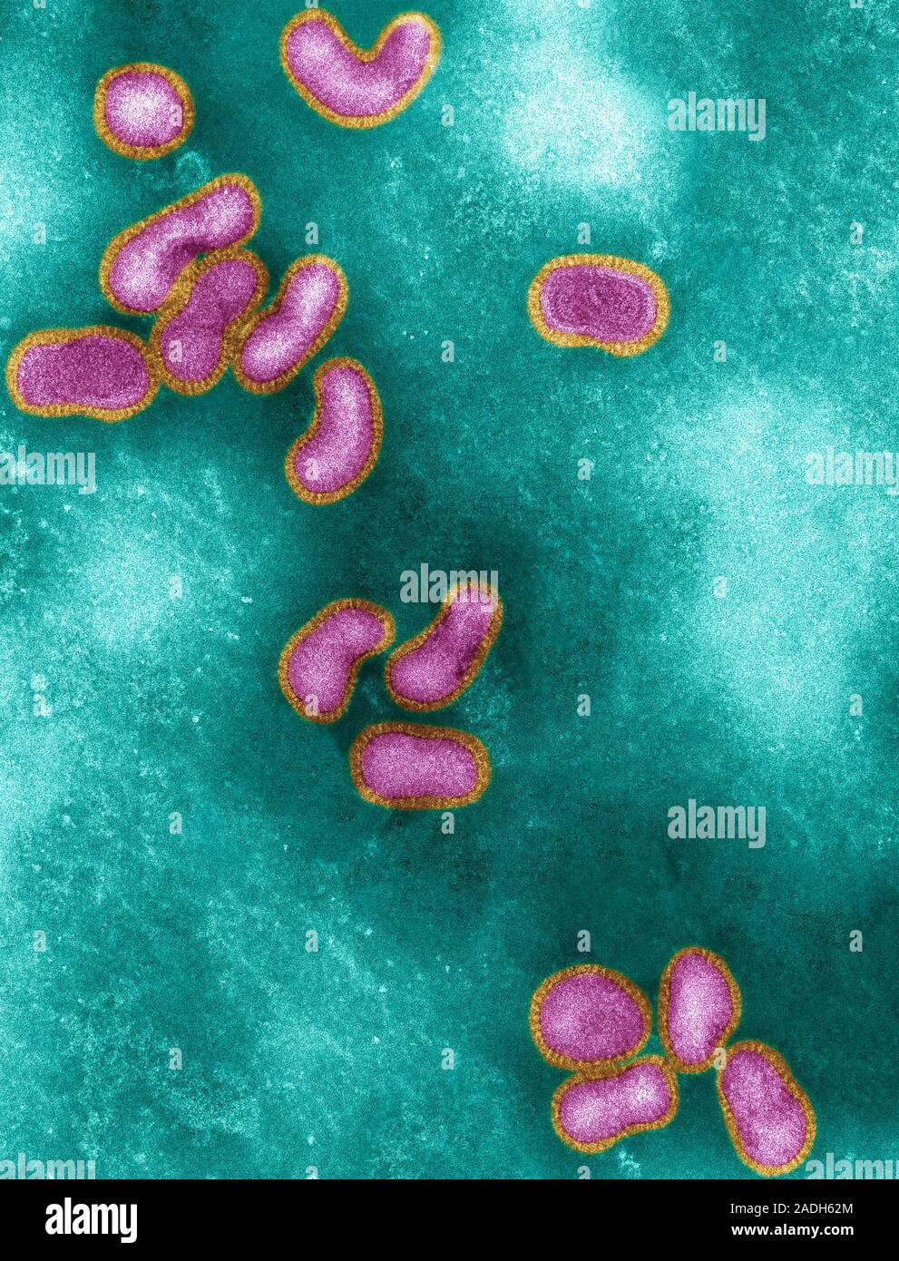 Avian influenza virus, type A strain H5N1, coloured transmission ...