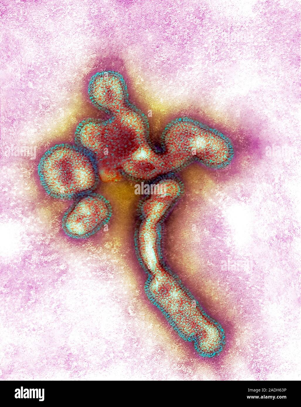 Human avian influenza virus, type A strain H5N1, coloured transmission ...