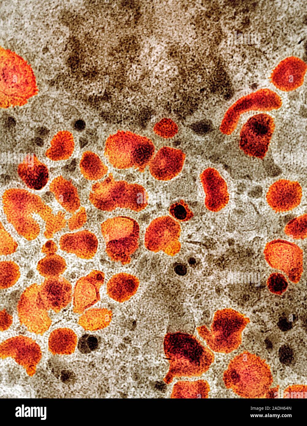 H5N1 avian influenza virus particles, coloured transmission electron ...