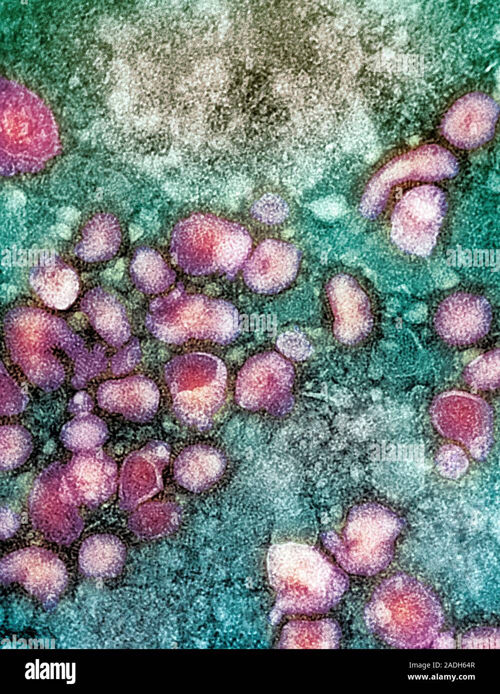 H5N1 avian influenza virus particles, coloured transmission electron ... H5N1 avian influenza virus particles, coloured transmission electron ...