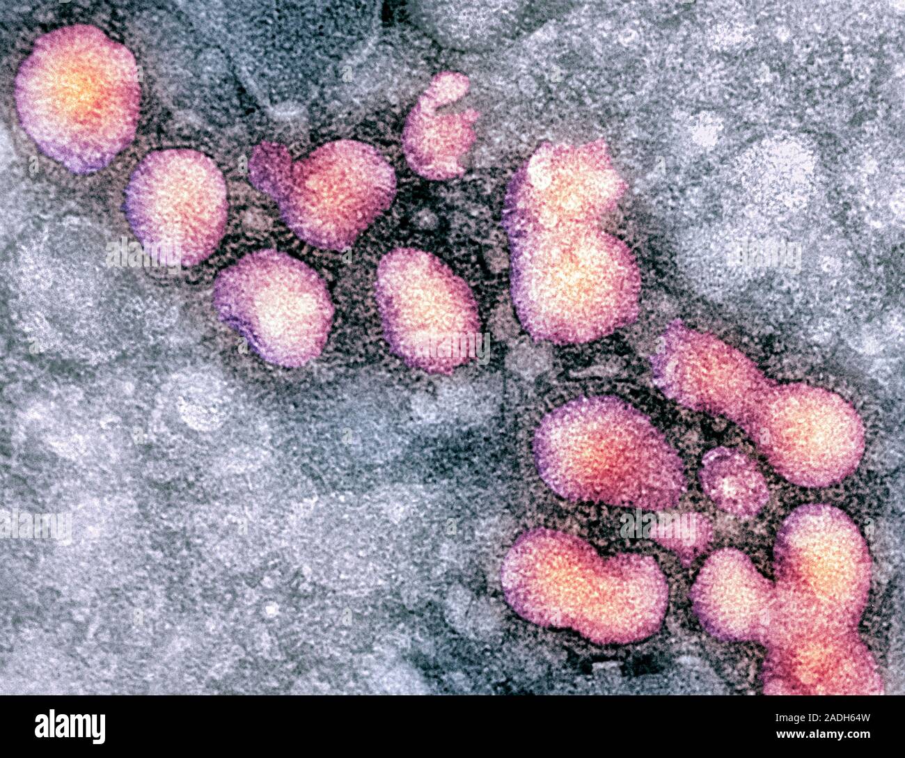 H5N1 avian influenza virus particles, coloured transmission electron ... H5N1 avian influenza virus particles, coloured transmission electron ...