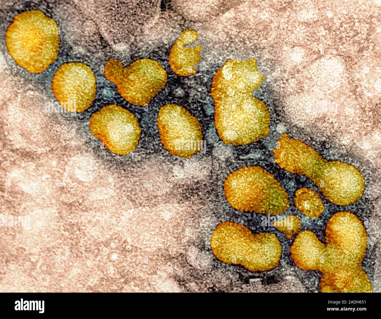 H5N1 avian influenza virus particles, coloured transmission electron ...