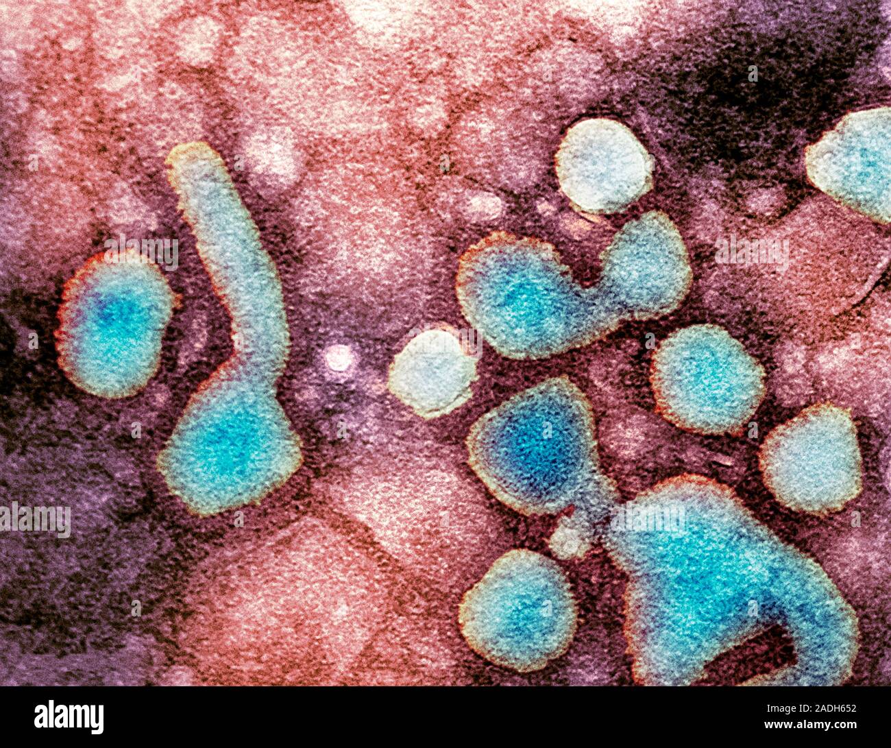 H5N1 avian influenza virus particles, coloured transmission electron ... H5N1 avian influenza virus particles, coloured transmission electron ...