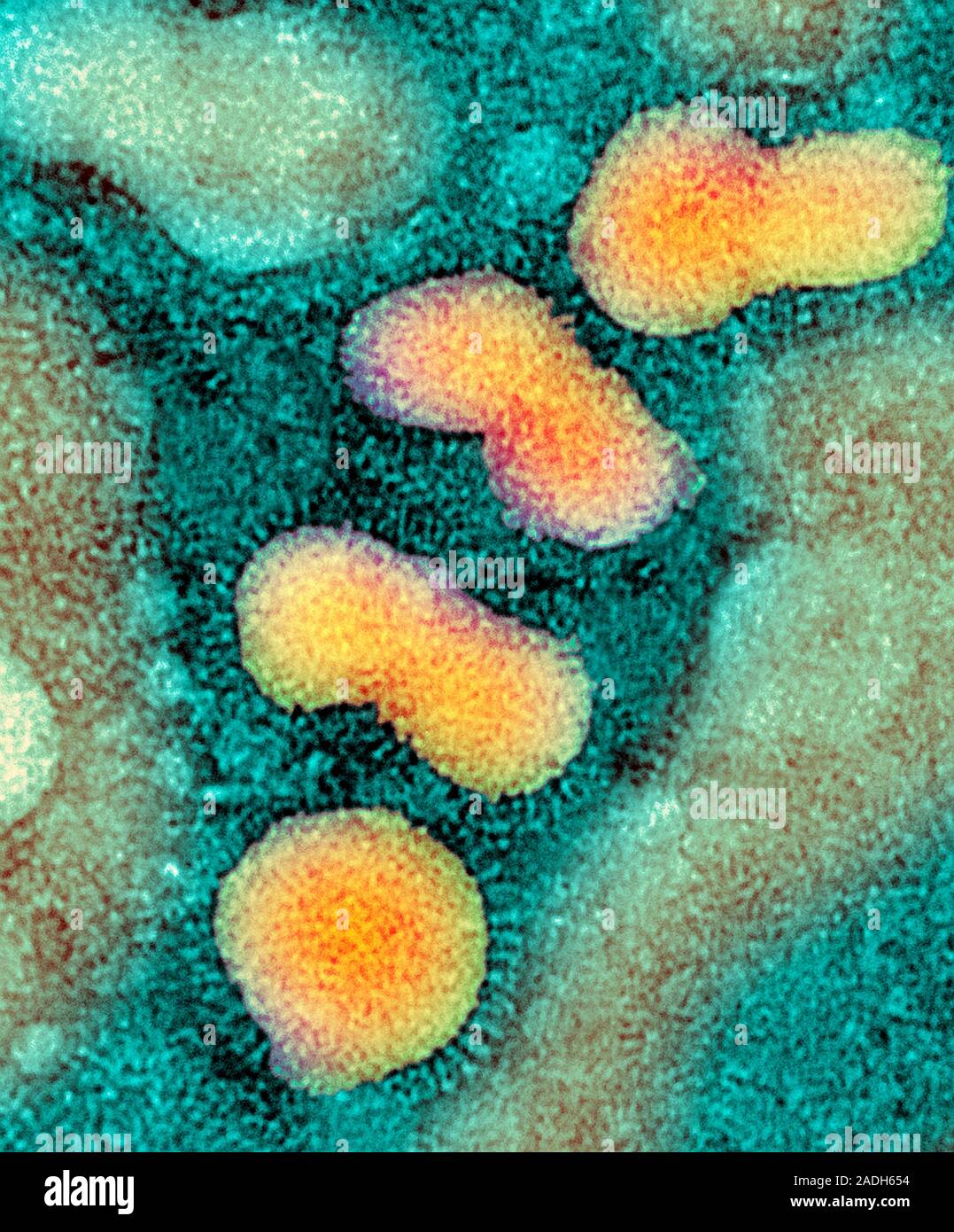 H5N1 avian influenza virus particles, coloured transmission electron ...