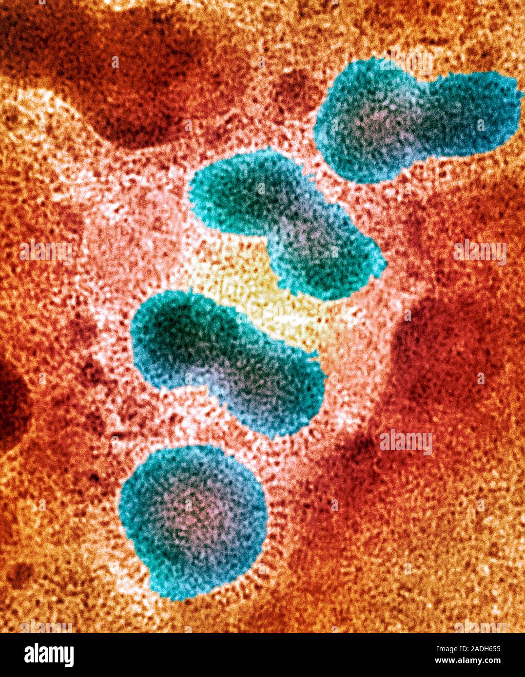 H5N1 avian influenza virus particles, coloured transmission electron ...