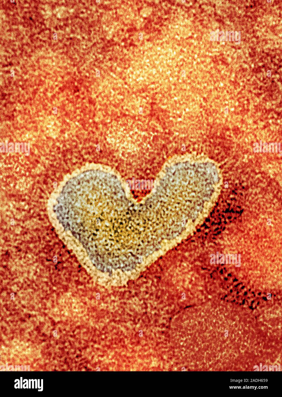 H5N1 avian influenza virus particle, coloured transmission electron ...