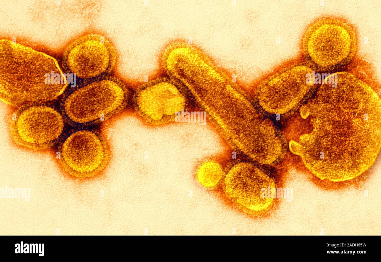 H1N1 1918 influenza virus particles (brown), coloured transmission ... H1N1 1918 influenza virus particles (brown), coloured transmission ...