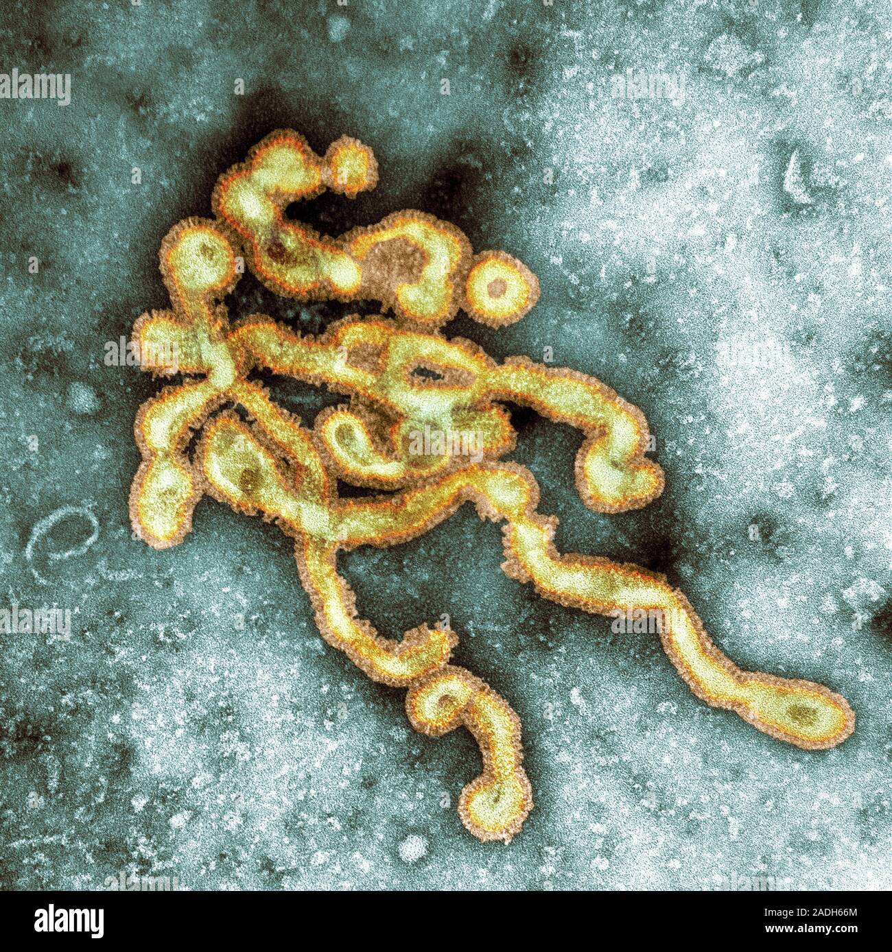 Influenzavirus C. Coloured transmission electron micrograph (TEM) of ...
