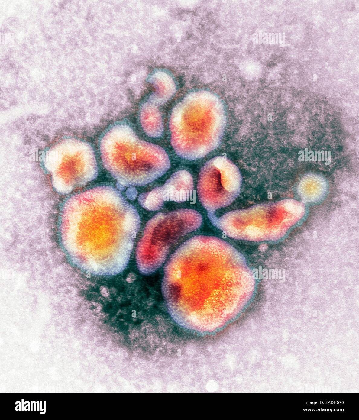 Avian influenza virus particles. Coloured transmission electron ...
