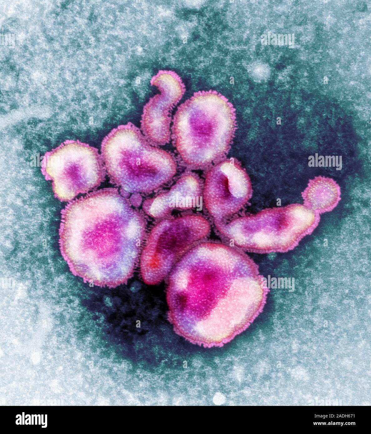 Avian influenza virus particles. Coloured transmission electron ...