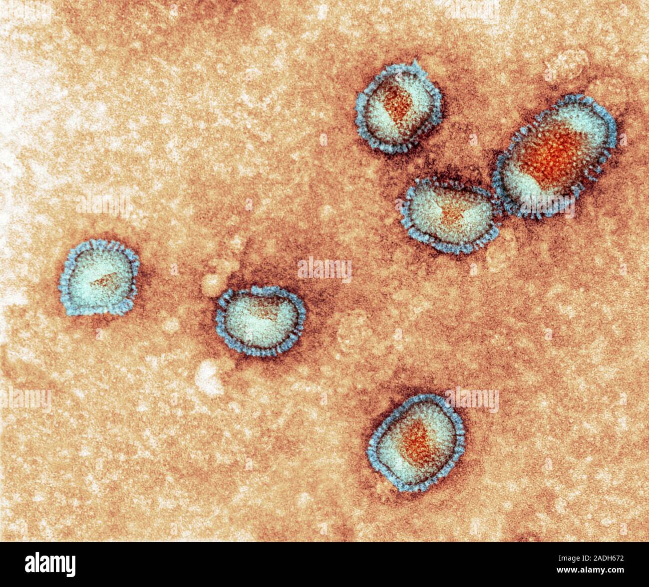 Influenzavirus B. Coloured transmission electron micrograph (TEM) of ...