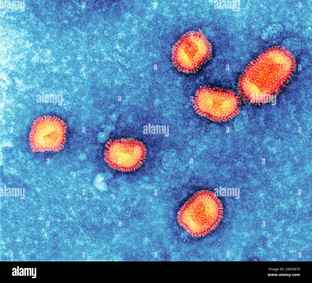 Influenzavirus B. Coloured transmission electron micrograph (TEM) of ...
