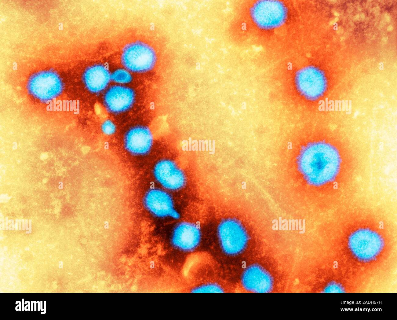Avian influenza virus particles. Coloured transmission electron micrograph (TEM) of a H5 strain ...