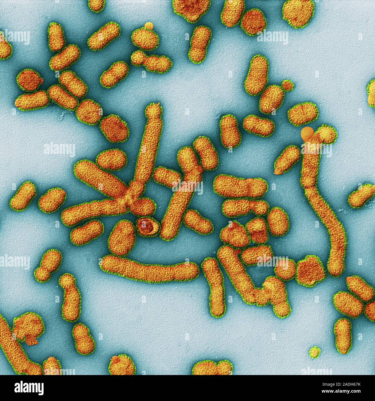 Influenza A virus particles, coloured scanning electron micrograph (SEM ...