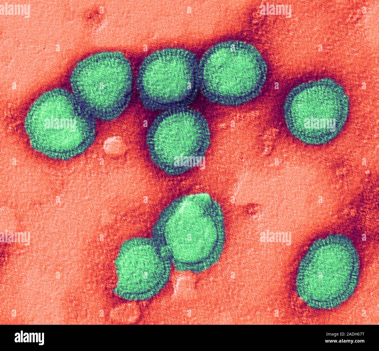 Influenzavirus B. Coloured transmission electron micrograph (TEM) of ...