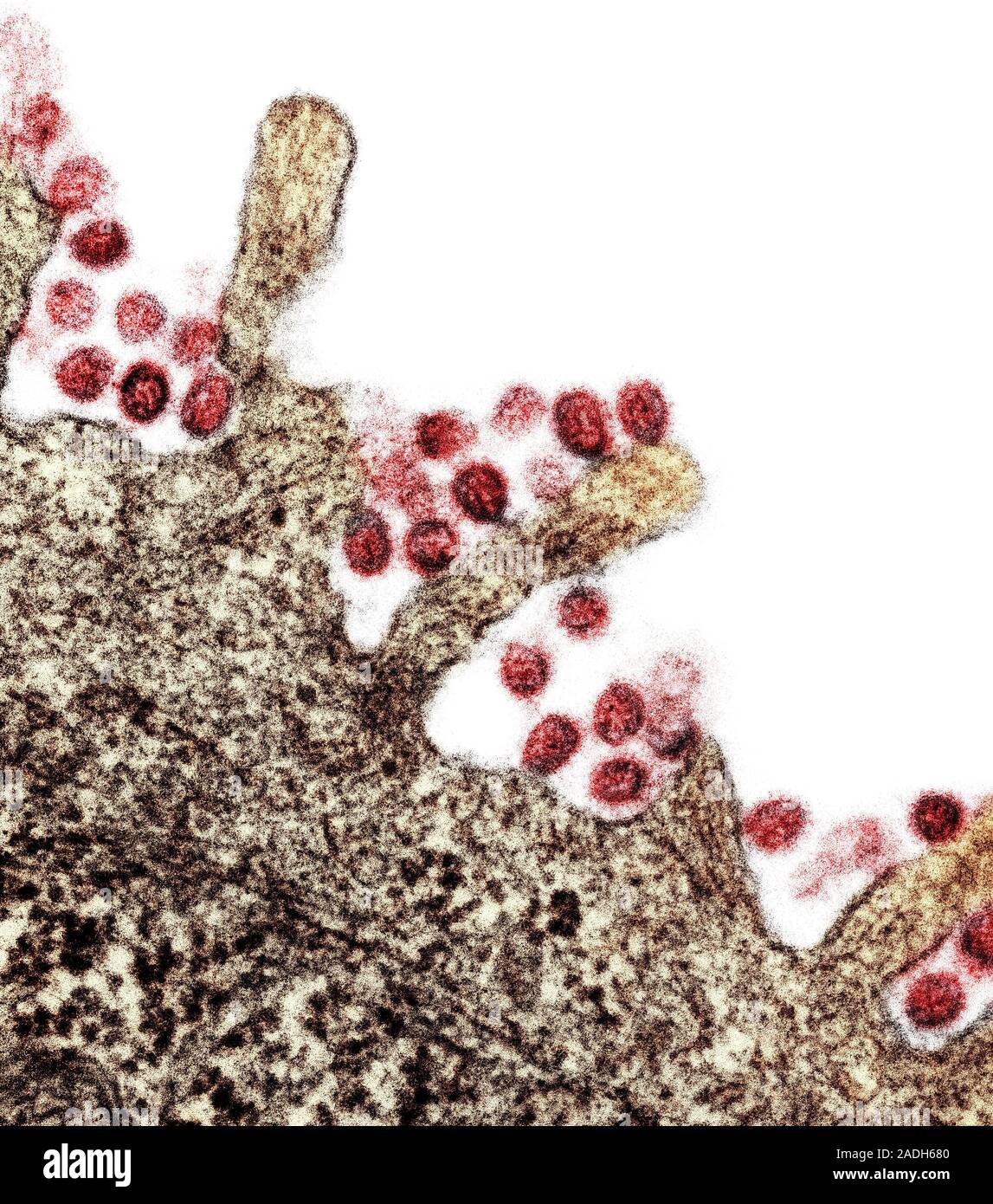 Influenza viruses. Coloured transmission electron micrograph (TEM) of ...